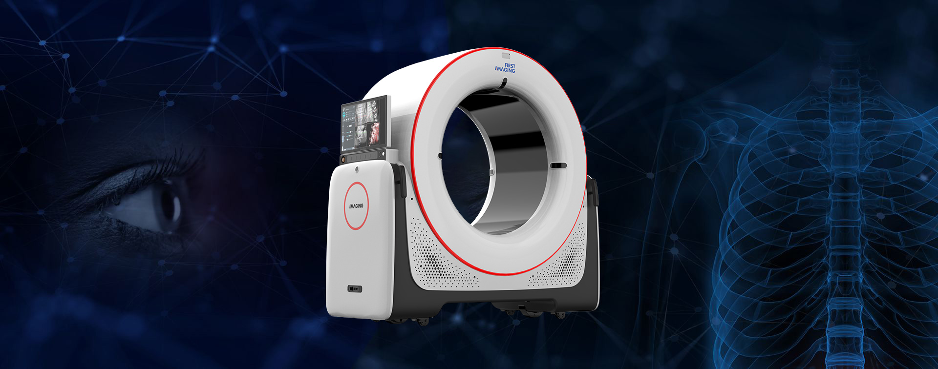 黄山Supero系列_移动式体层摄影设备-一影医疗